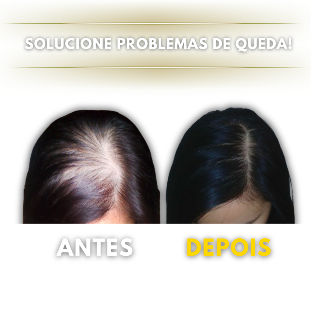 apostiladigital exterior – Tricologia e Terapia Capilar em Foco