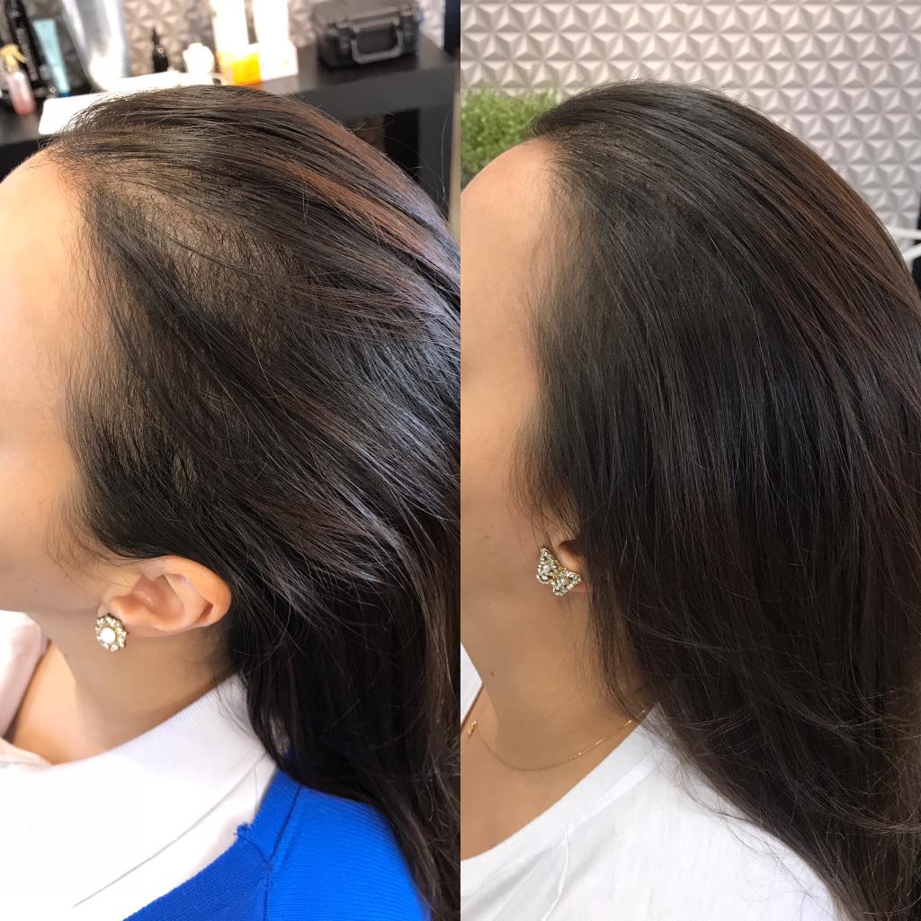 apostiladigital exterior – Tricologia e Terapia Capilar em Foco